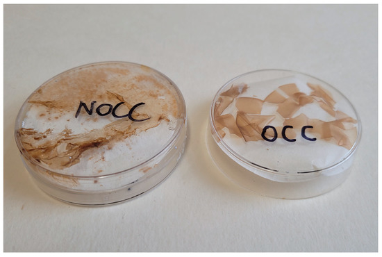 Molecules | Free Full-Text | Chitosan and Its Carboxymethyl-Based Membranes Produced by ...