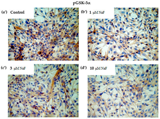 Fluoride as a Potential Repressor of Glycogen Metabolism in Skeletal ...