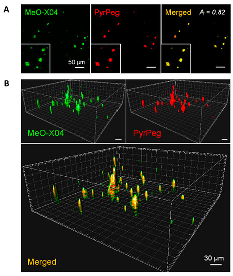 Two-Photon Fluorescent Probes for Amyloid-β Plaques Imaging In Vivo