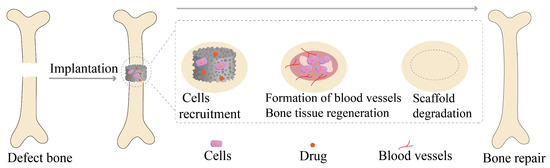 Drug Delivery and Therapy Strategies for Osteoporosis Intervention