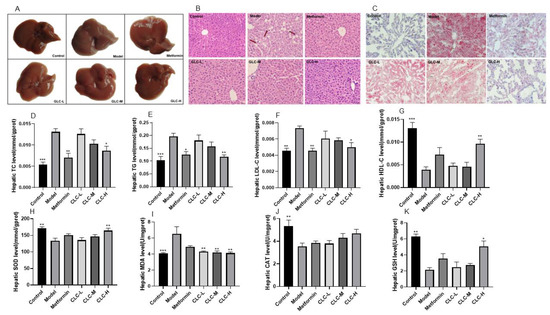 Glucosamine Improves Non-Alcoholic Fatty Liver Disease Induced by High ...