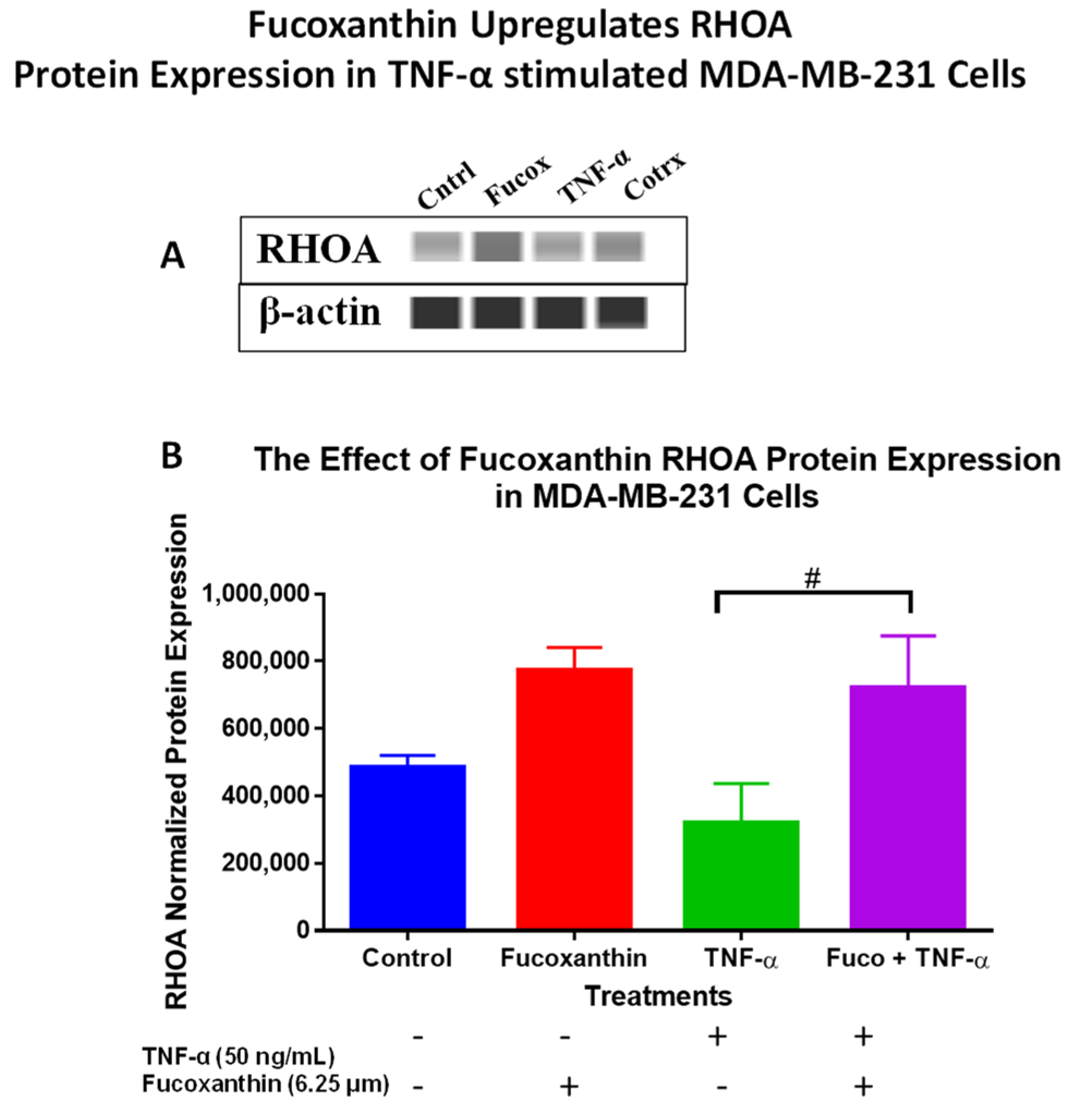 Molecules | Free Full-Text | The Anticancer Effects of Marine Carotenoid Fucoxanthin through ...