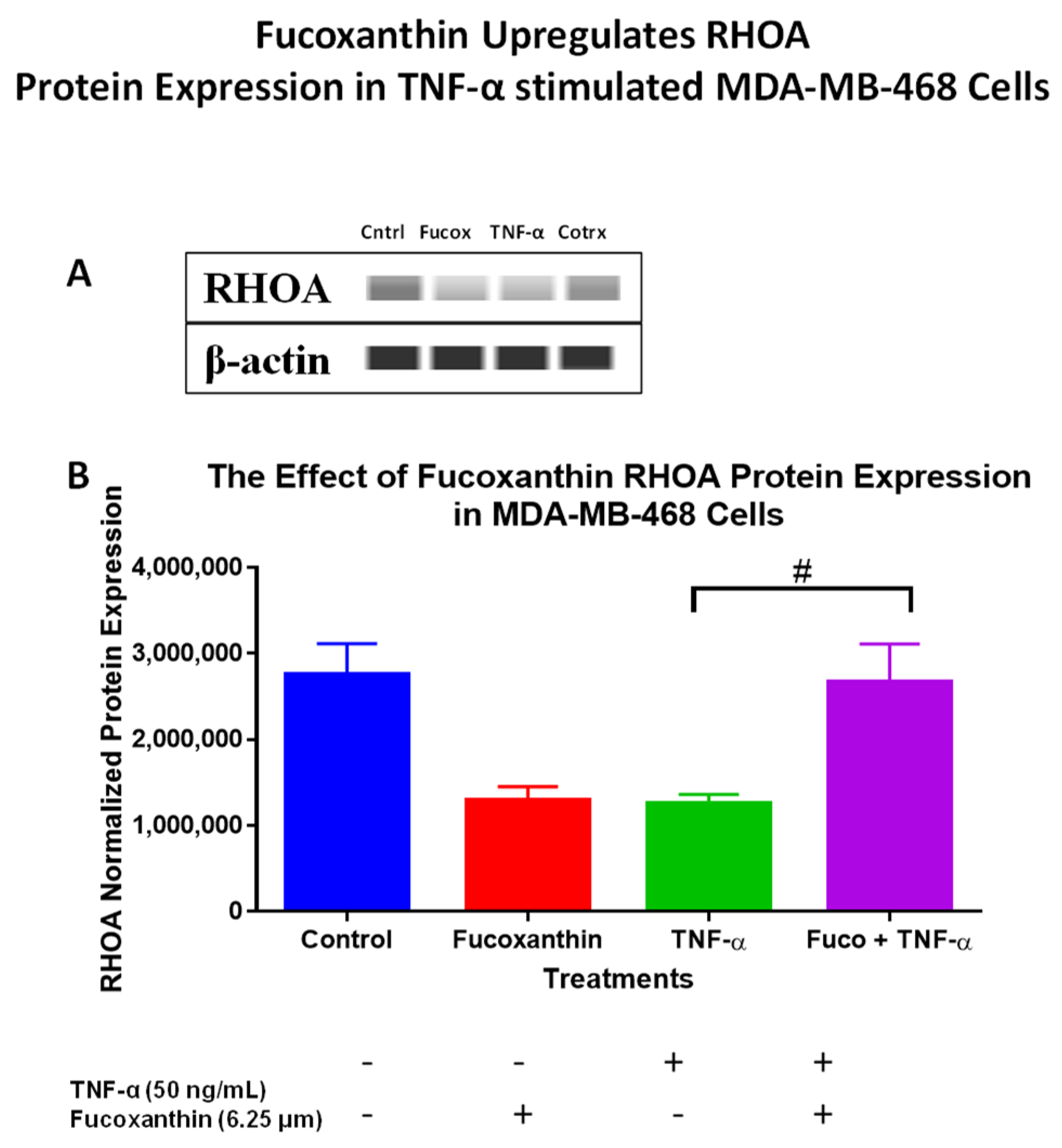 Molecules | Free Full-Text | The Anticancer Effects of Marine Carotenoid Fucoxanthin through ...