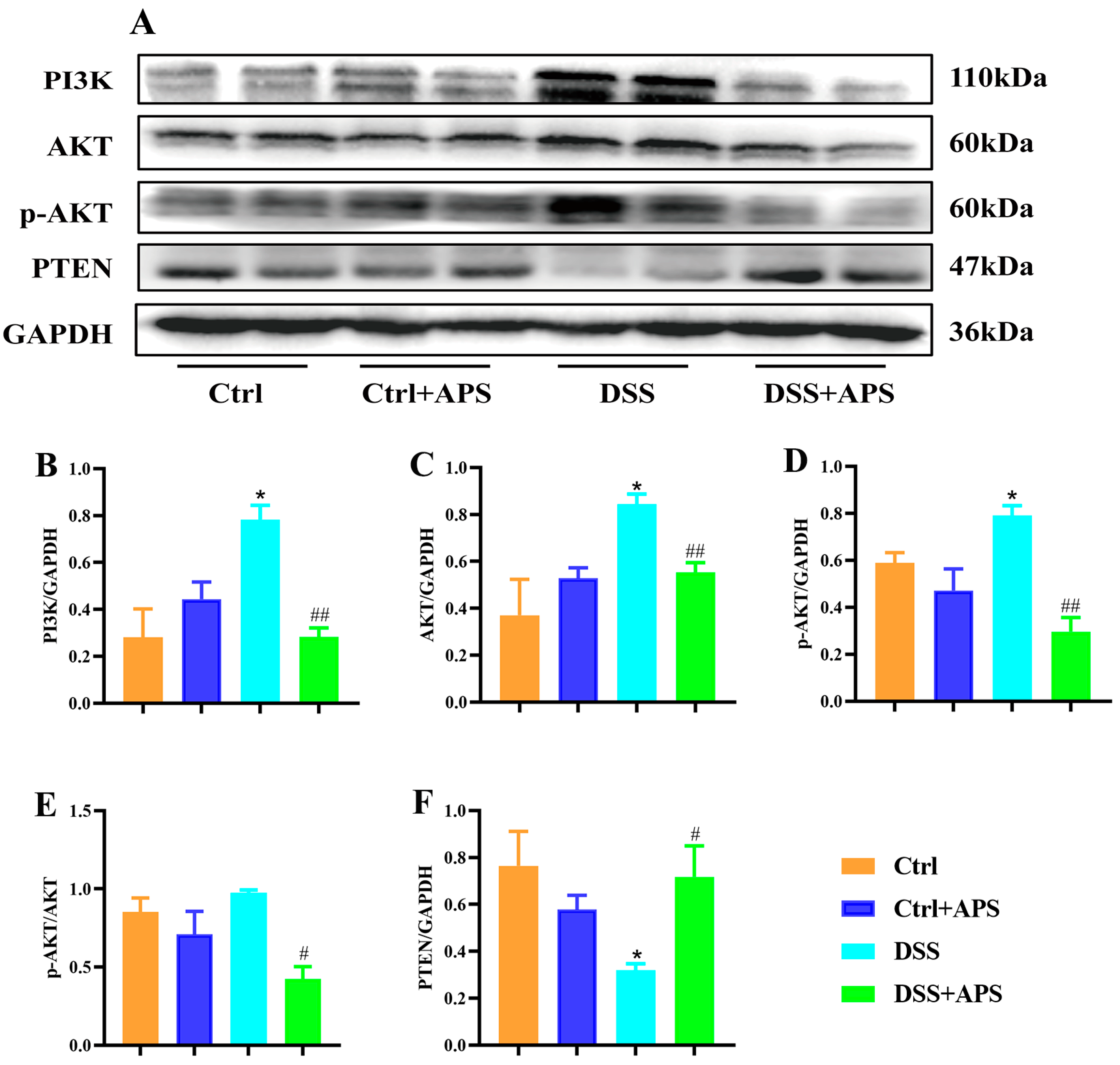 Astragalus Polysaccharide Alleviates Ulcerative Colitis by Regulating ...