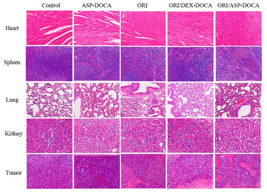 Angelica Sinensis Polysaccharide-Based Nanoparticles for Liver-Targeted ...