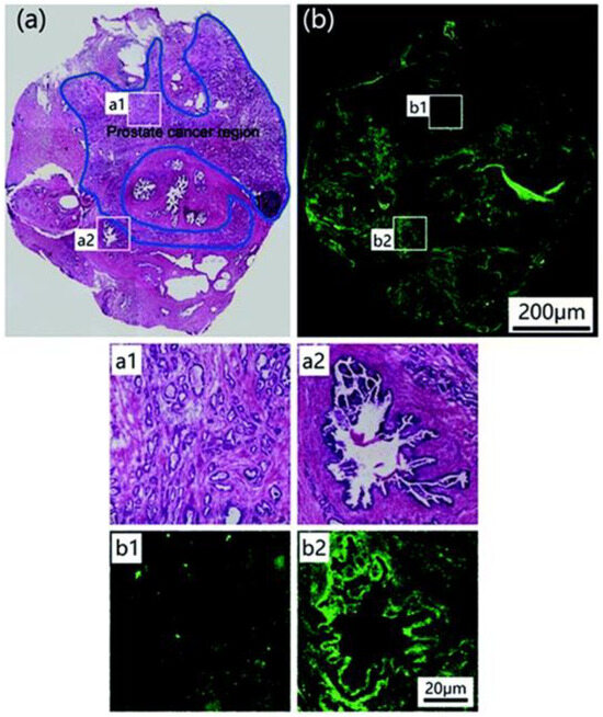 Advances in Organic Fluorescent Probes for Intracellular Zn2+ Detection and Bioimaging