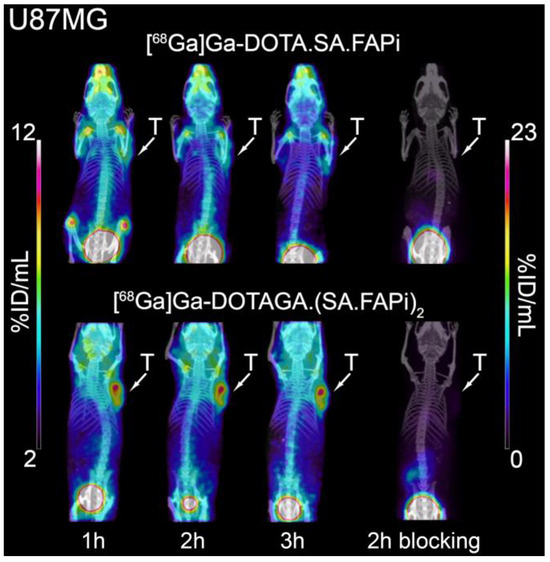 Tailoring Fibroblast-Activation Protein Targeting for Theranostics: A ...