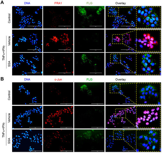 Molecules | Free Full-Text | Saikosaponin A Recovers Impaired Filaggrin ...