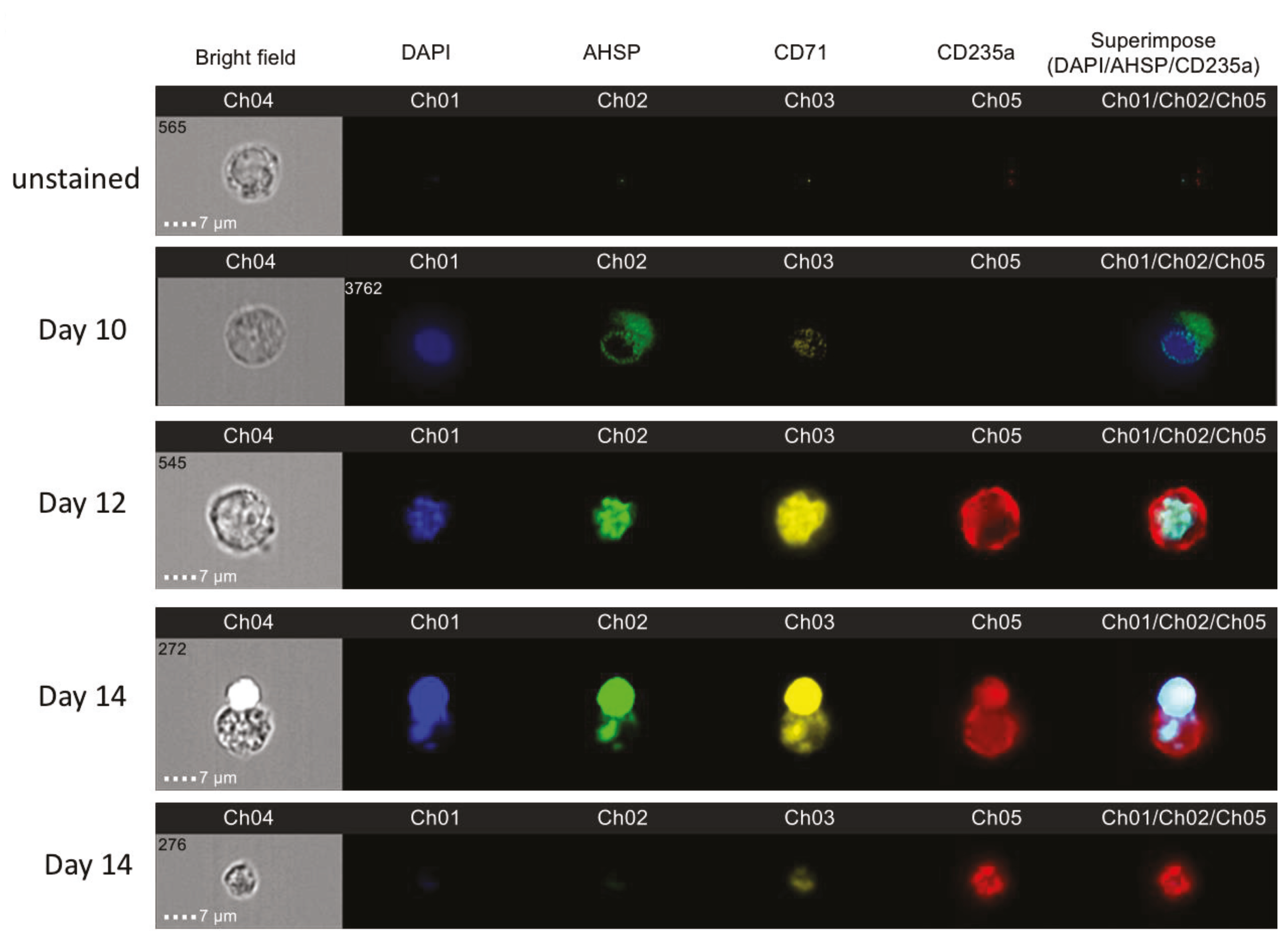 Stage Specific Expression Pattern of Alpha-Hemoglobin-Stabilizing ...