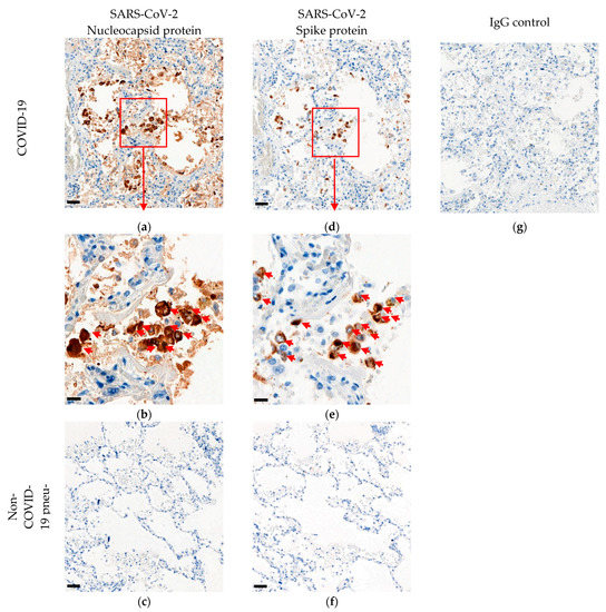 Sensitive and Specific Immunohistochemistry Protocol for Nucleocapsid ...