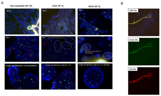Improvement of the Collection, Maintenance, and Analysis of Neoplastic ...