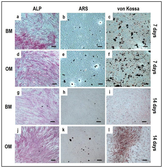 Protocol of Co-Culture of Human Osteoblasts and Osteoclasts to Test ...