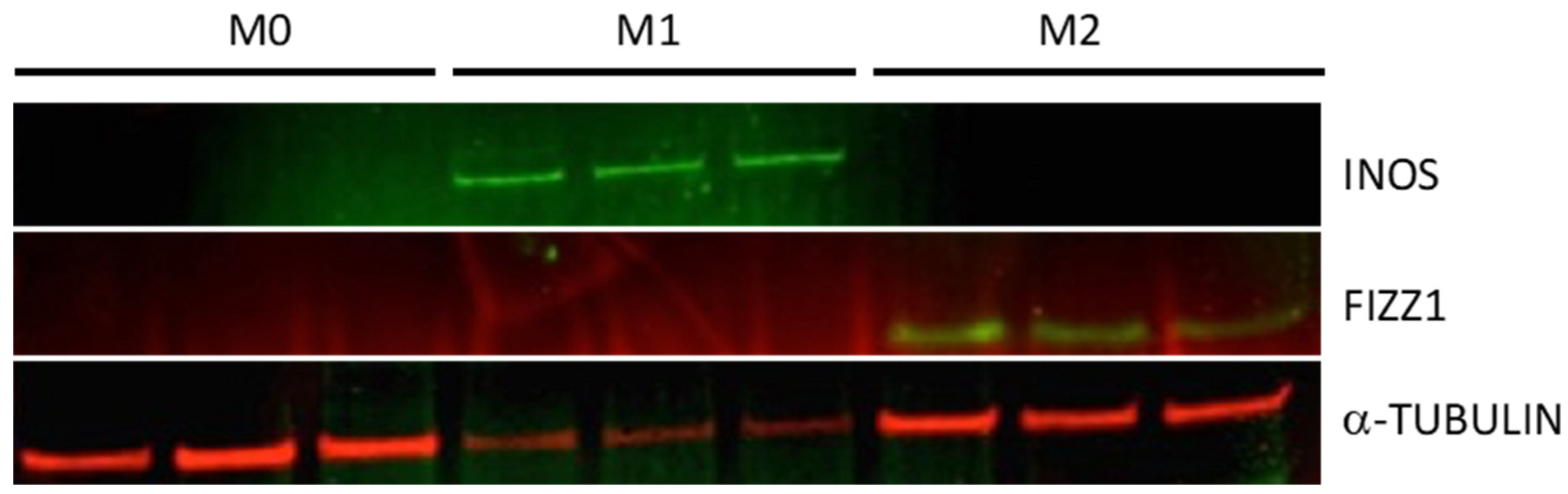 In Vitro Screening Method for Characterization of Macrophage Activation ...