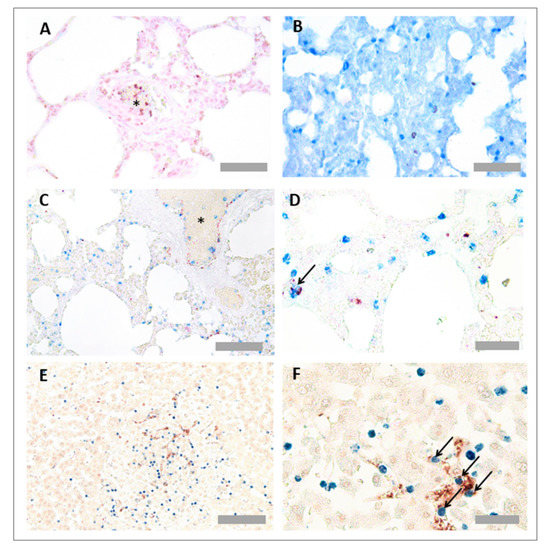 Single and Multiplex Immunohistochemistry to Detect Platelets and ...