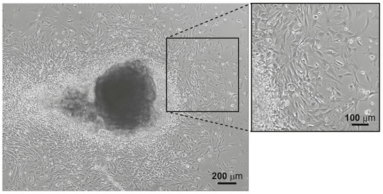 Optimized Protocol for Isolation and Culture of Murine Neonatal Primary ...