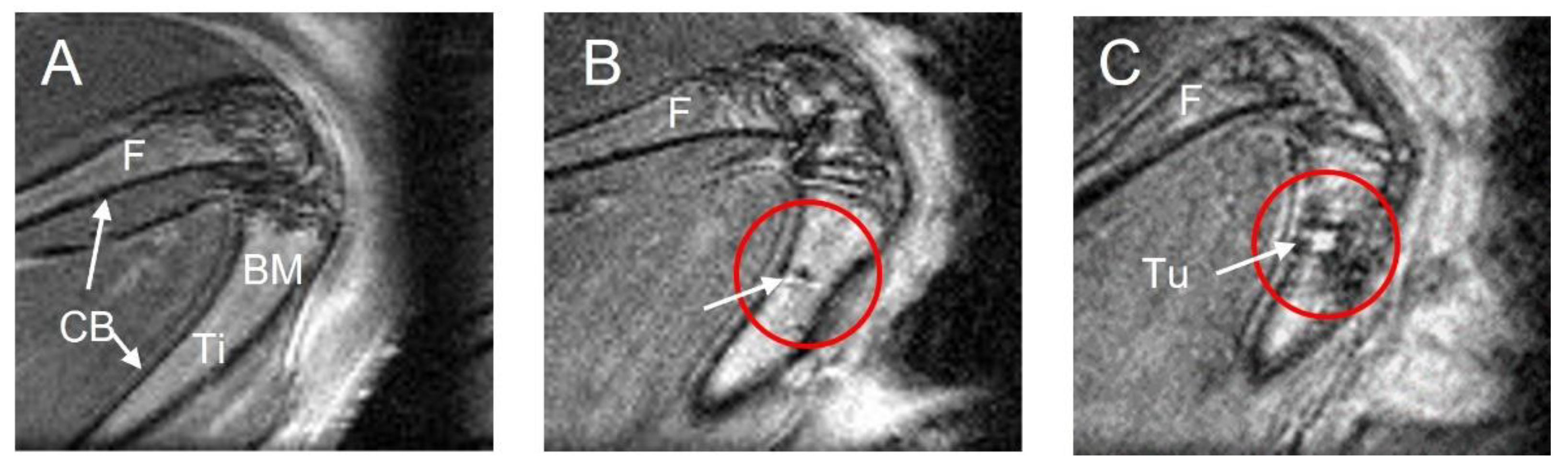 Magnetic Resonance Imaging as a Tool for Monitoring Intratibial Growth ...