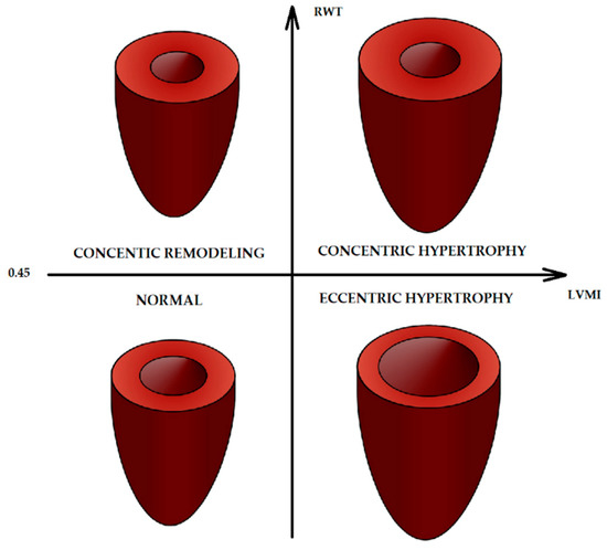 Restoration of Arterial Blood Flow Access to Rhomboid Fossa Assists in ...