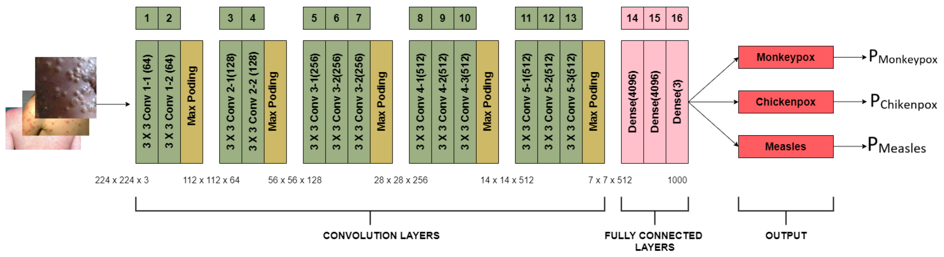 MTI | Free Full-Text | An Enhanced Diagnosis of Monkeypox Disease Using Deep Learning and a ...