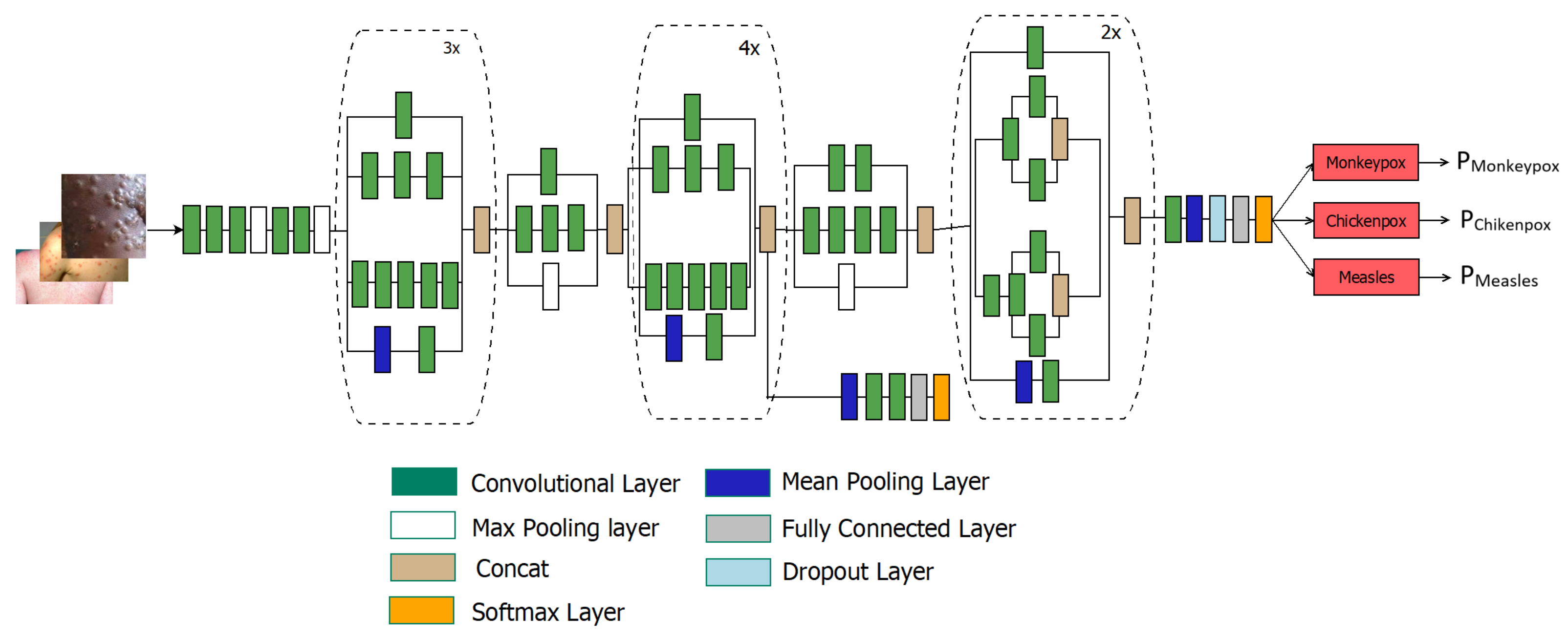 MTI | Free Full-Text | An Enhanced Diagnosis of Monkeypox Disease Using Deep Learning and a ...