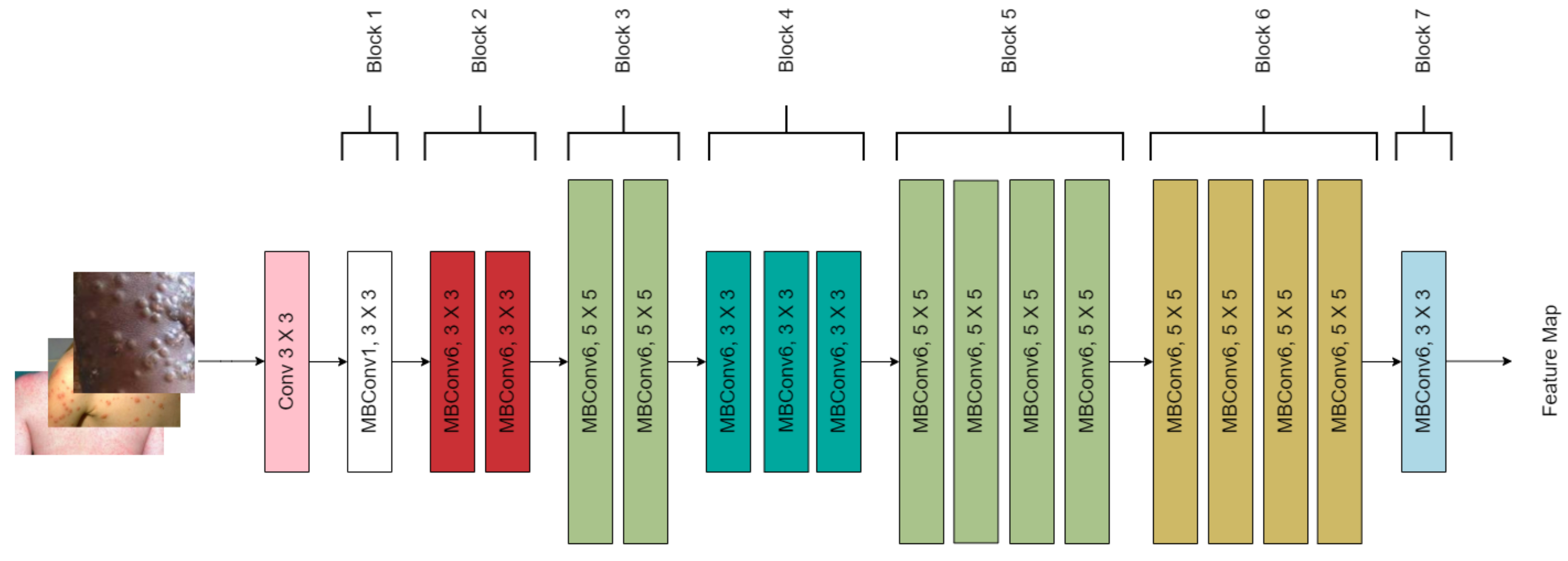 MTI | Free Full-Text | An Enhanced Diagnosis of Monkeypox Disease Using Deep Learning and a ...