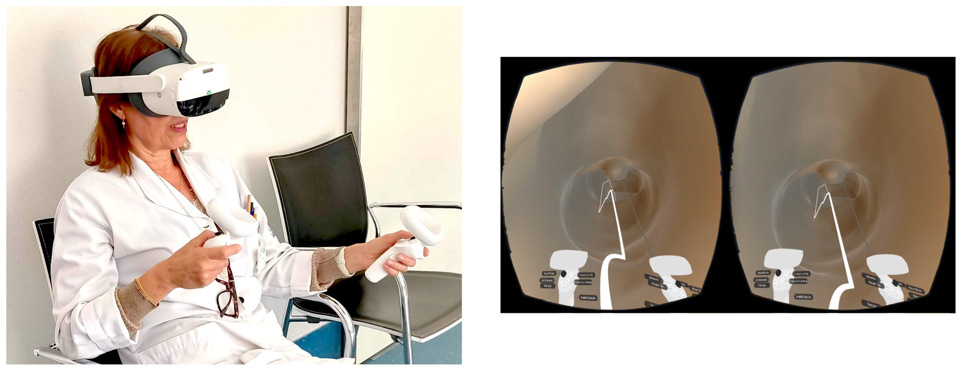 Immersive Virtual Colonography Viewer for Colon Growths Diagnosis ...