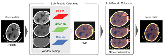 Application of 9-Channel Pseudo-Color Maps in Deep Learning for ...