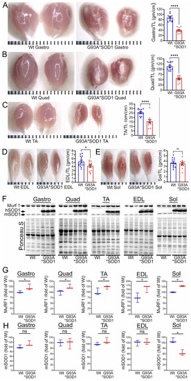 Pathological Sequelae Associated with Skeletal Muscle Atrophy and ...