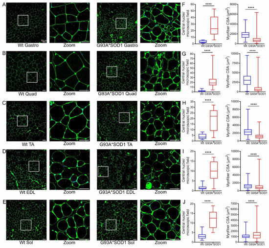 Pathological Sequelae Associated with Skeletal Muscle Atrophy and ...