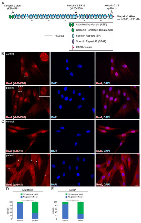 An Intronic Heterozygous SYNE2 Splice Site Mutation: A Rare Cause for ...