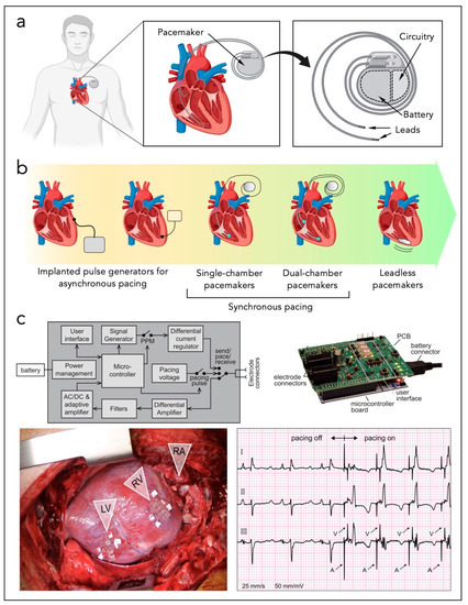 Heart Energy Harvesting and Cardiac Bioelectronics: Technologies and Perspectives