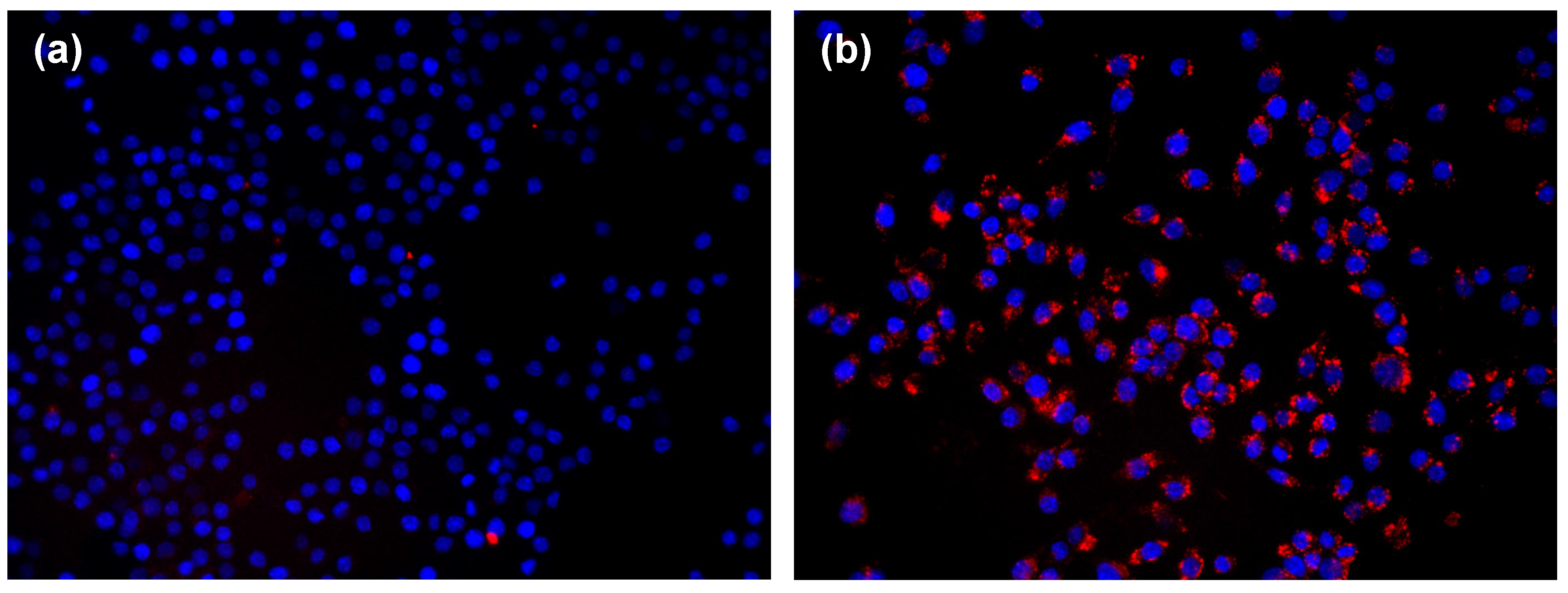Nanomaterials | Free Full-Text | Iron Oxide Nanoparticles Coated with a ...