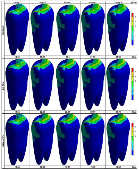 Nanomaterials | Free Full-Text | Effect of Fiber Posts on Stress ...