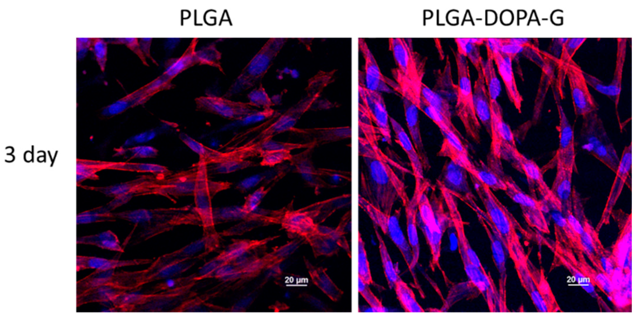 PLGA Membranes Functionalized with Gelatin through Biomimetic Mussel ...