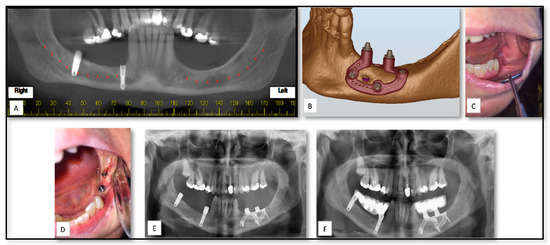 Three-Dimensional Technology Applications in Maxillofacial ...