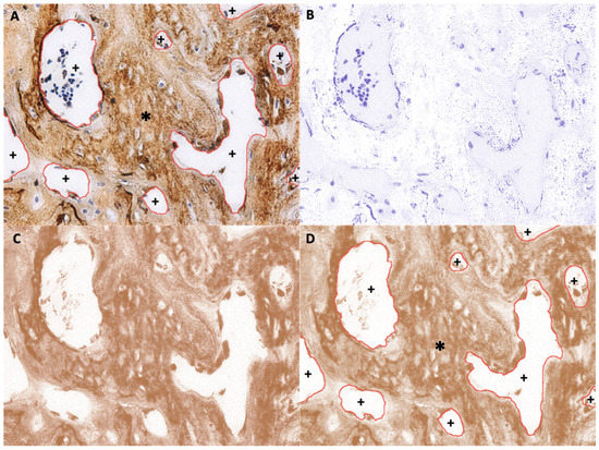 Nanomaterials | Free Full-Text | Bone Regeneration Capacity of Newly ...