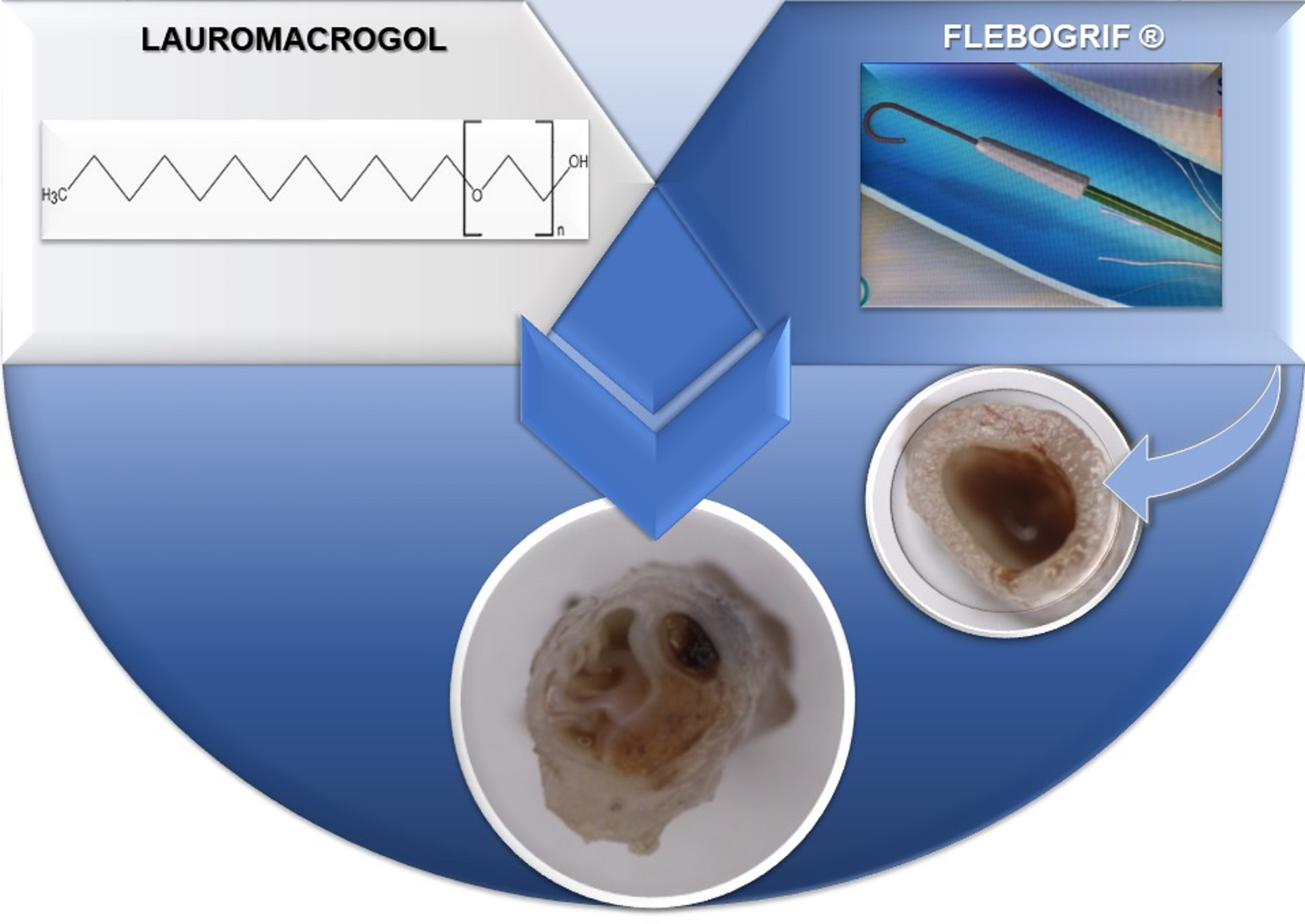 Nanomaterials | Free Full-Text | Study of Flebogrif®—A New Tool for ...