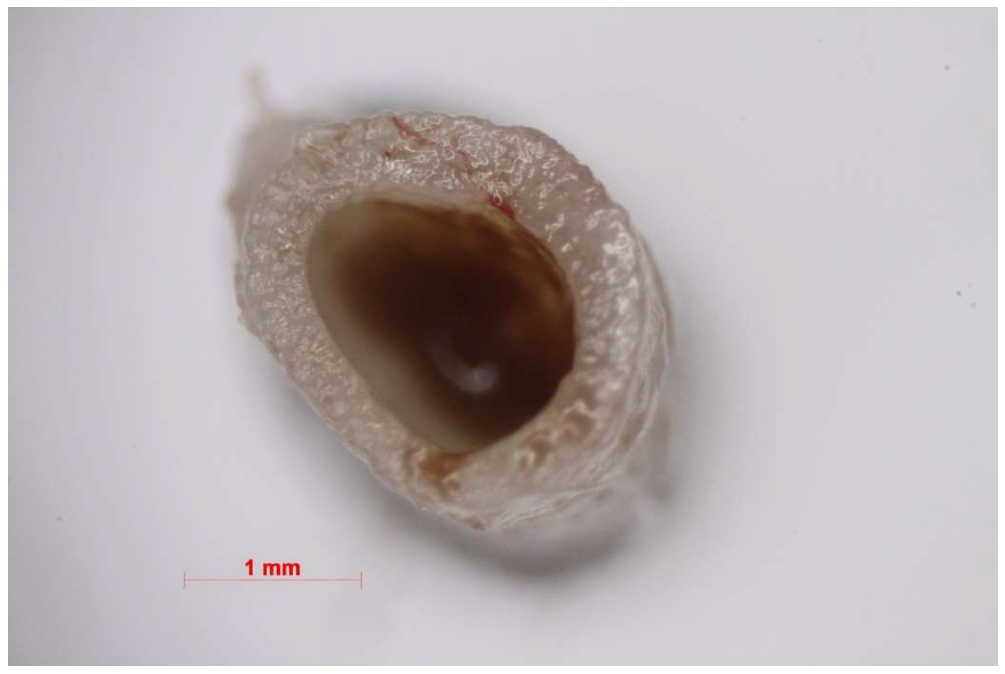 Study of Flebogrif®—A New Tool for Mechanical Sclerotherapy ...