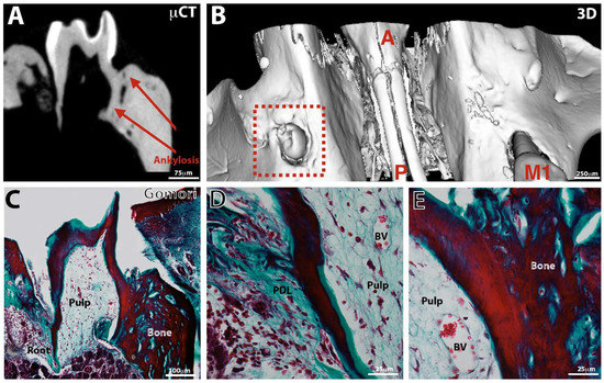 Eruption of Bioengineered Teeth: A New Approach Based on a ...