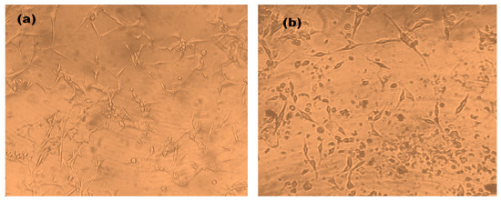 Green Synthesis of Silver Nanoparticles Using Diospyros malabarica Fruit Extract and Assessments ...