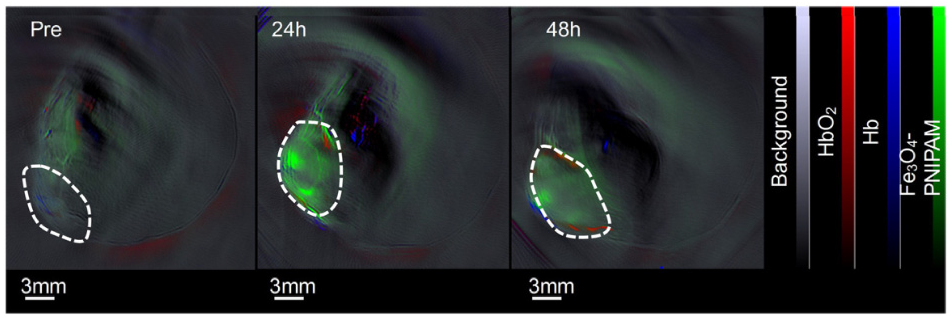 Exogenous Contrast Agents in Photoacoustic Imaging: An In Vivo Review ...