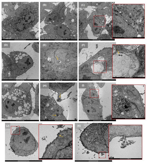 Nanomaterials | Free Full-Text | Analysis of the In Vitro Toxicity of Nanocelluloses in Human ...