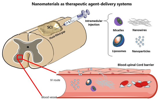 Applications of Various Types of Nanomaterials for the Treatment of ...