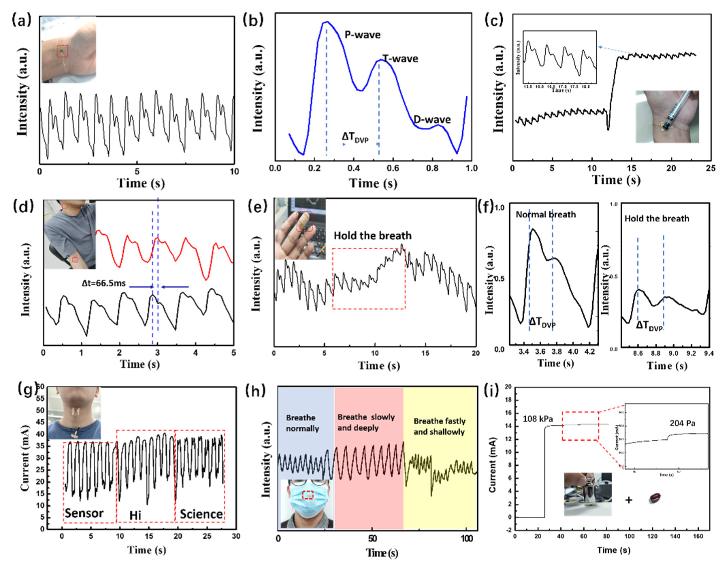 Highly Sensitive Piezoresistive Pressure Sensor Based on Super-Elastic ...