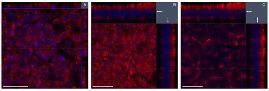 Nanomaterials | Free Full-Text | Different Sensitivity of Advanced Bronchial and Alveolar Mono ...