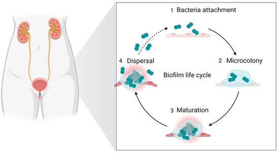 Nanotechnology Involved in Treating Urinary Tract Infections: An Overview