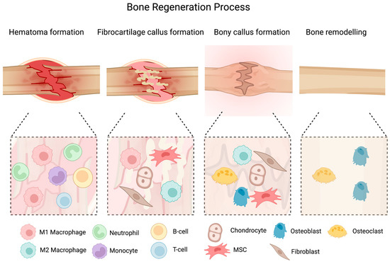Osteoimmunomodulatory Nanoparticles for Bone Regeneration