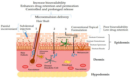 Exploring the Versatility of Microemulsions in Cutaneous Drug Delivery ...