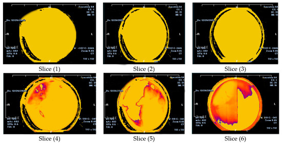 X-ray Computed Tomography (CT) to Scan the Structure and Characterize ...