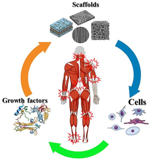 Bioactive Nanostructured Scaffold-Based Approach for Tendon and Ligament Tissue Engineering