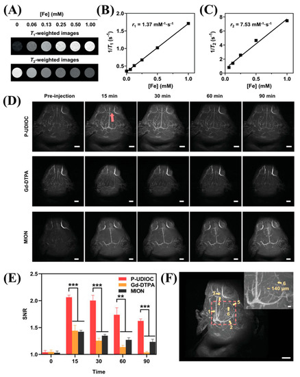 Contrast Agents of Magnetic Resonance Imaging and Future Perspective